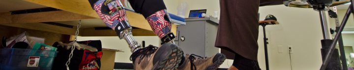 Prosthetic Issues – Tips for Amputees | MCOP Prosthetics