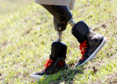 Overview of Prosthetic Liner Types & Applications | MCOP Prosthetics