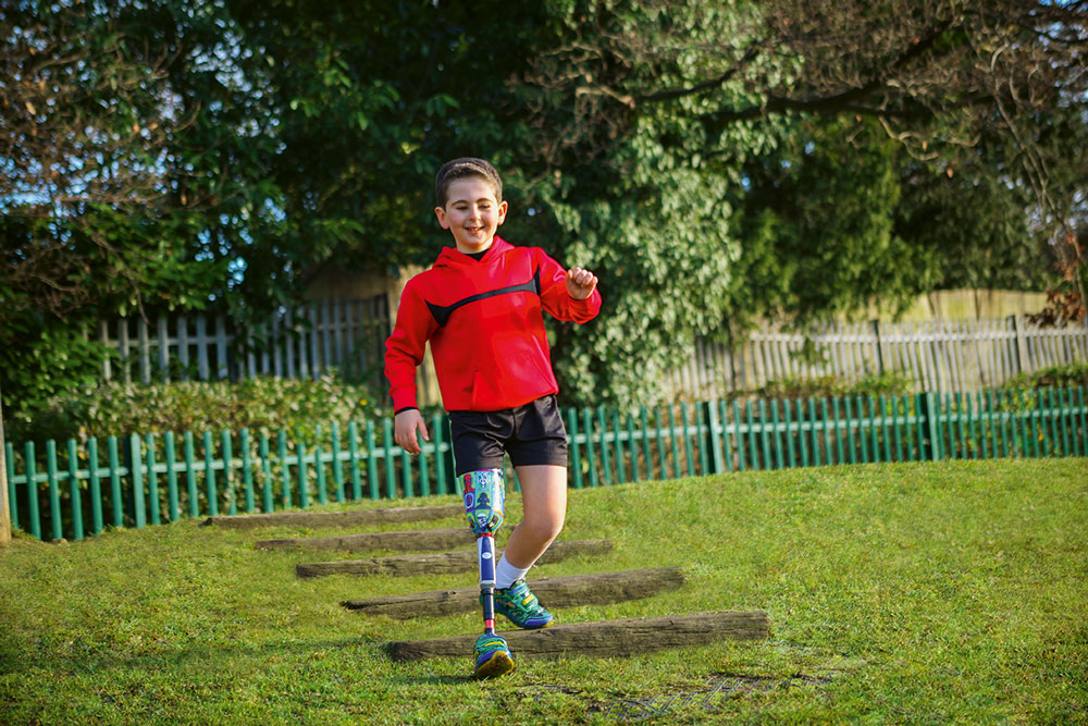 Pediatric Amputee Support: Back to School | MCOP Prosthetics