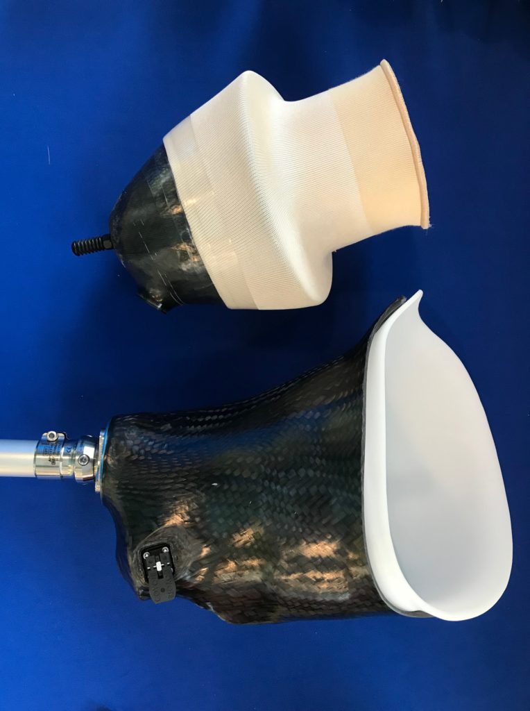 Can a double wall socket double your socket comfort? | MCOP Prosthetics