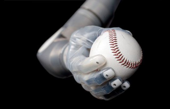 Mobius Bionics LUKE Arm | MCOP Prosthetics