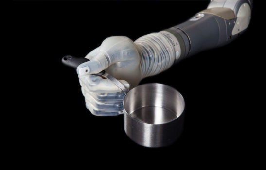 Mobius Bionics LUKE Arm | MCOP Prosthetics