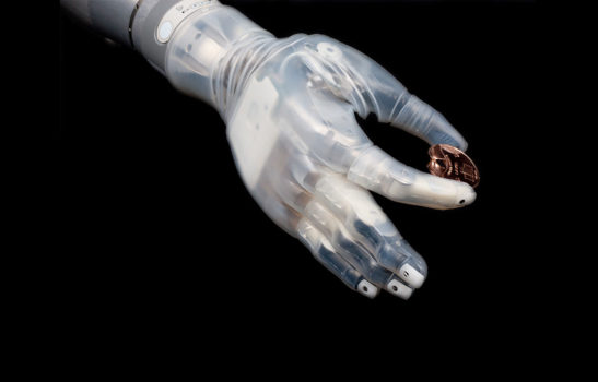 Mobius Bionics LUKE Arm | MCOP Prosthetics