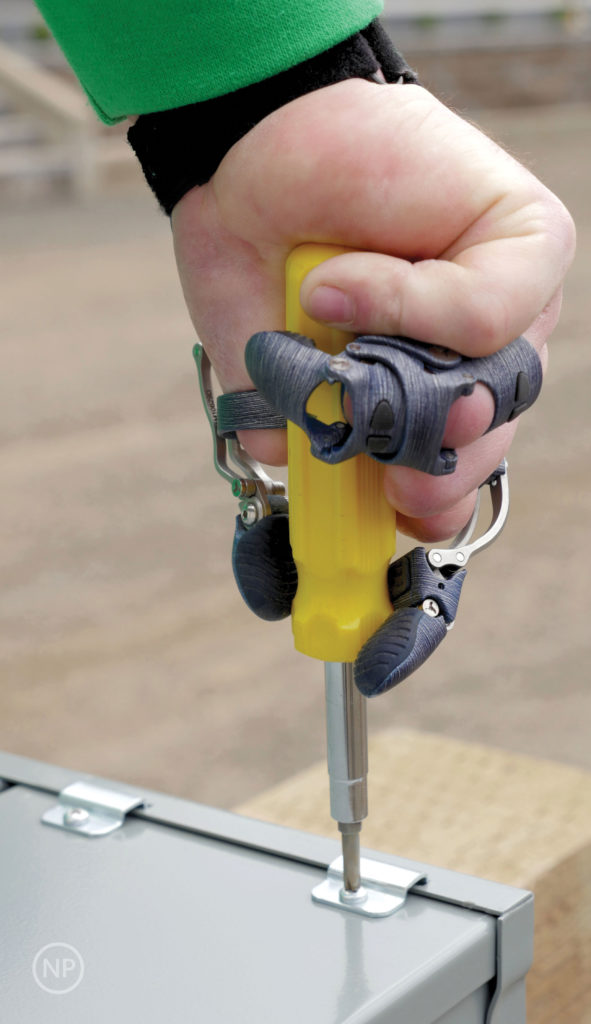 Hand & Finger Prosthetics | MCOP